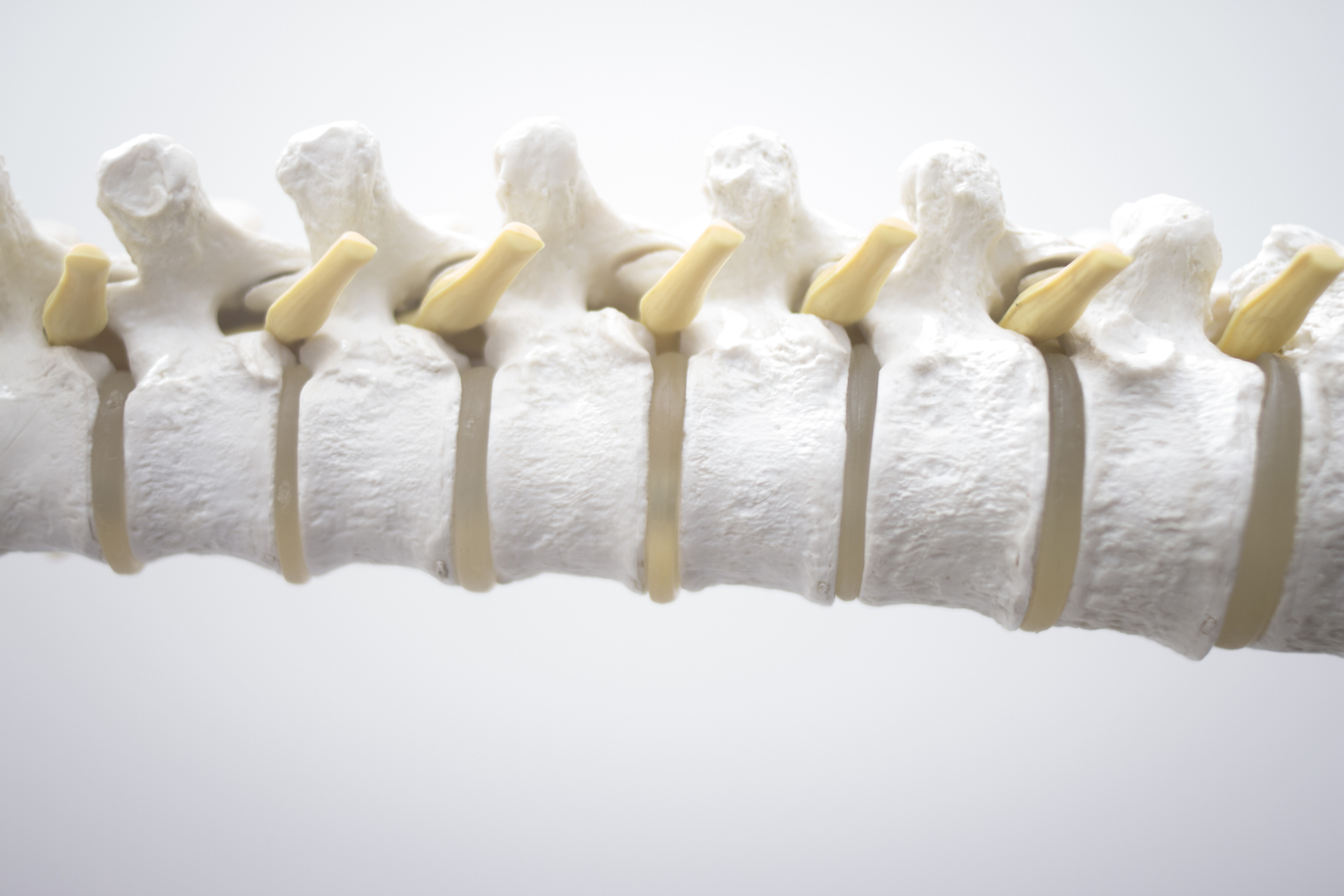 What is a foraminotomy?