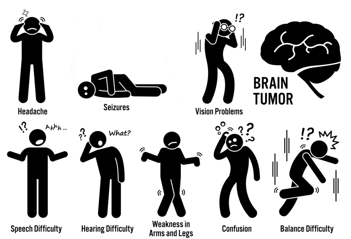What Are Some Common Brain Tumor Symptoms?